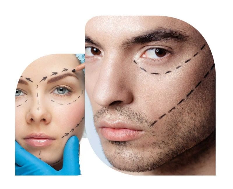 Scar Revision | Scar Correction | Cleveland Cosmetic Surgery