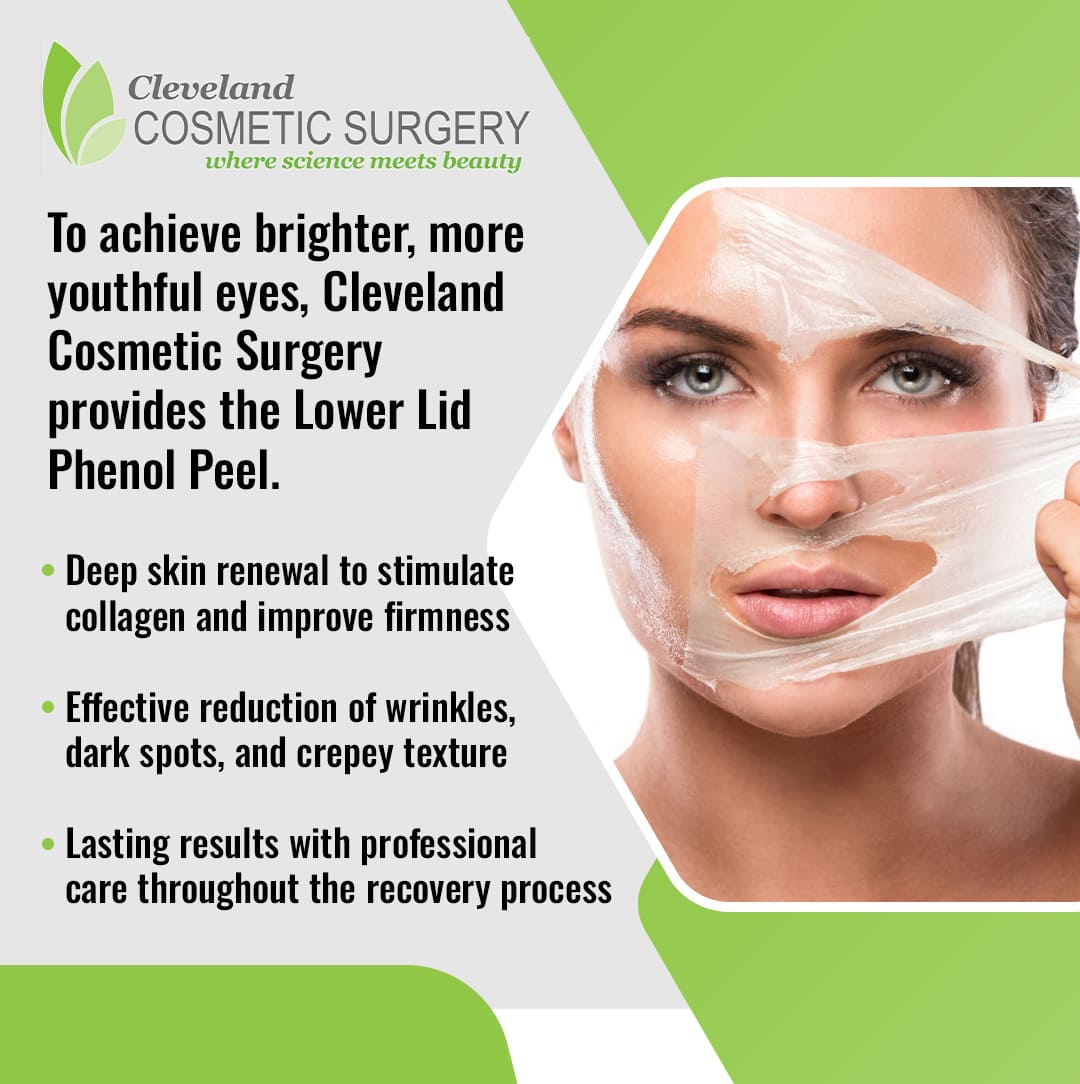 Lower Lid Phenol Peel: Smooth and Brighten the Eyes for a Youthful You ...