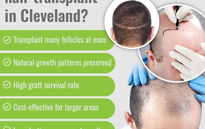 What Is the Nefertiti Neck Lift and How Does It Work?